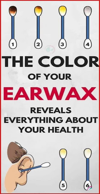 THE COLOR OF YOUR EARWAX REVEALS EVERYTHING ABOUT YOUR HEALTH - Health ...