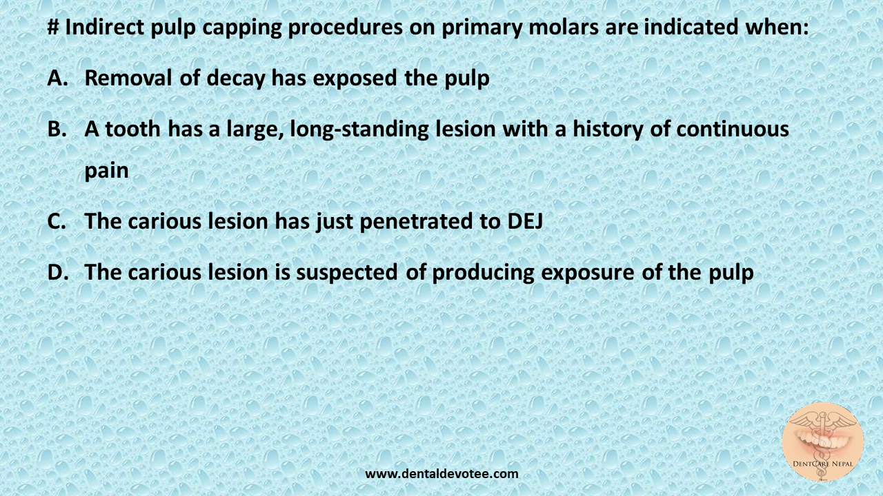 Dentosphere : World of Dentistry: Indirect pulp capping procedures on ...