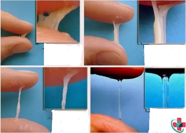Common Abnormal Vaginal Discharges And How To Treat Them Common Abnormal Vaginal Discharges And How To Treat Them