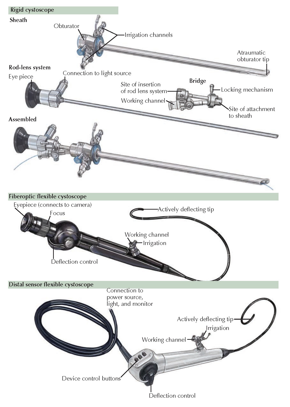 Cystoscopy Pediagenosis