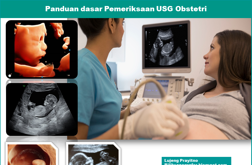Panduan Dasar Pemeriksaan USG Obstetri