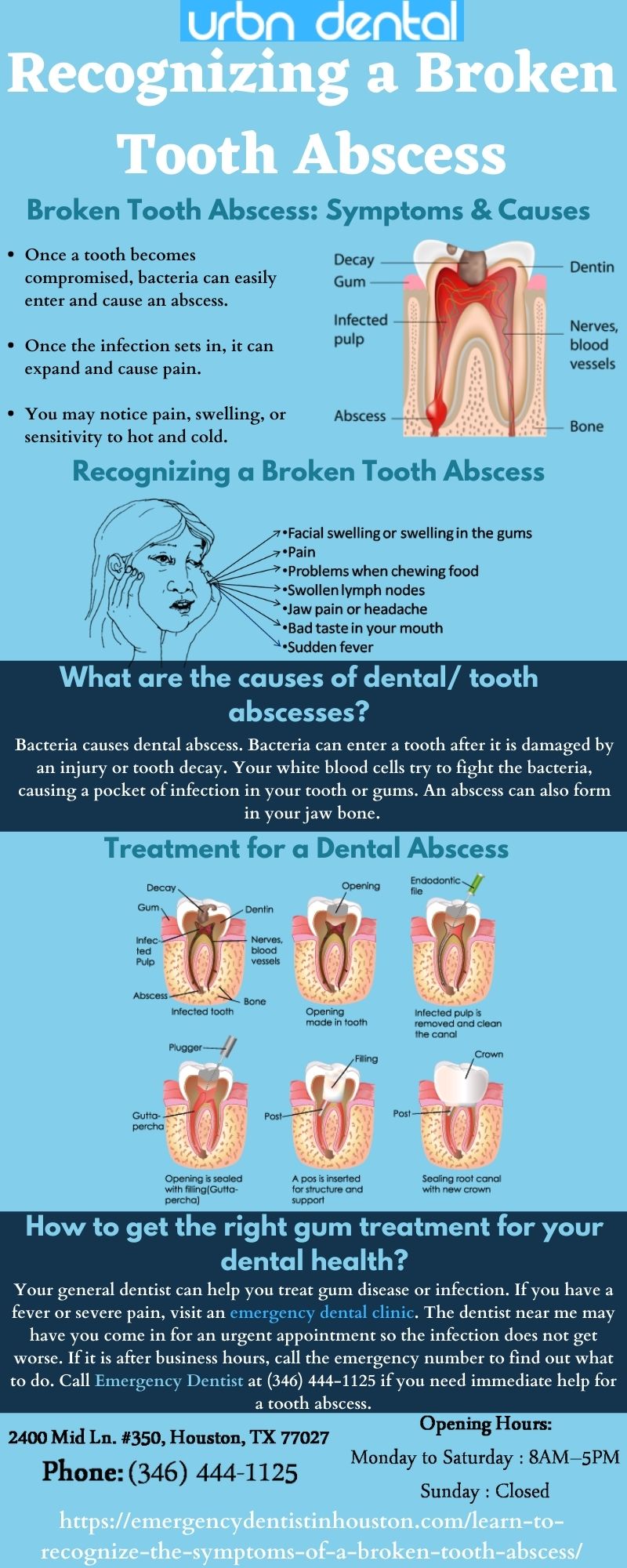 Recognizing a Broken Tooth Abscess