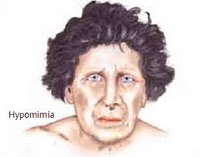 Francinia Fernanda Ferrira: Facies