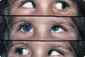 Eye 2 Eye Optometrists: Prescription of Prisms in Combined ( Horizontal ...