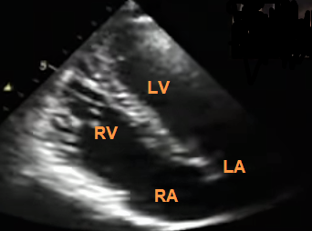 Cardiology: A modern free online cardiology ebook and cardiology cases ...