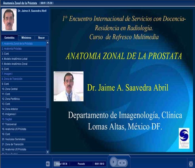 Todo Ecografía Médica: Anatomía Zonal de la Próstata