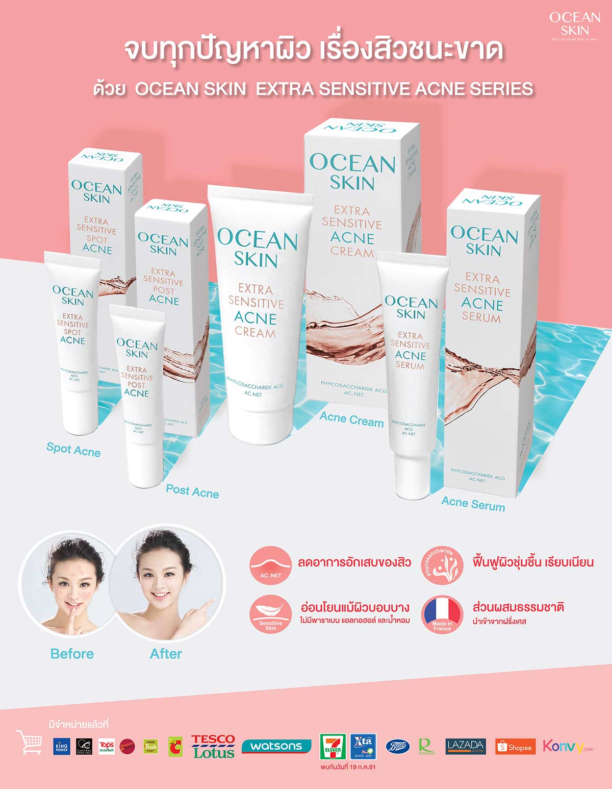 ผิวแพ้เก่ง เป็นสิวง่าย ต้องมี “Ocean Skin Acne Series” | วิธีรักษาสิว ...