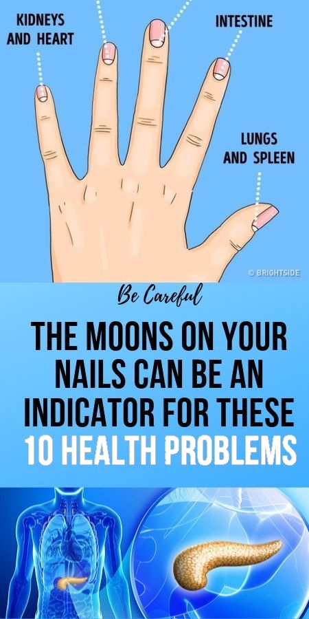 Your Nails Can Be A Good Indicator Of Health Problems - wellness magazine