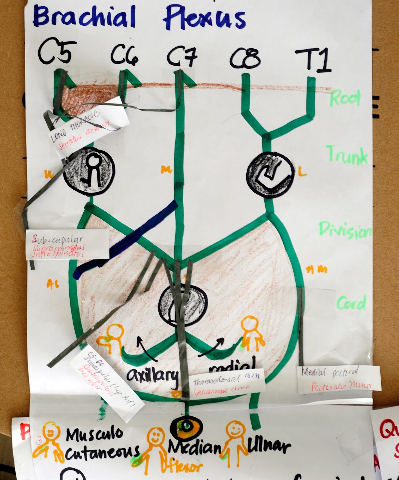 Ginuhit sa Alikabok: Scarred Brachial Plexus Dog: Brachial Plexus ...