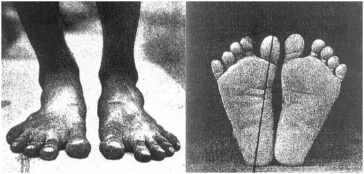 Bigfoot Feet