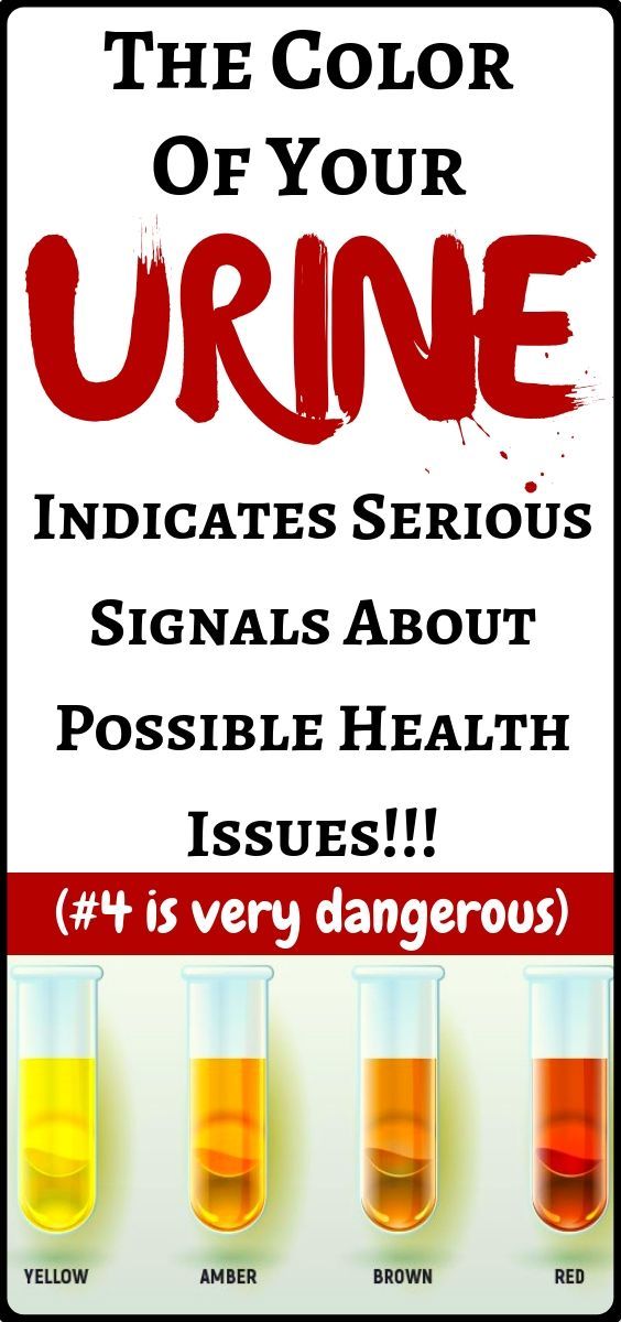 What the color of your urine and frequent urination can tell you about ...