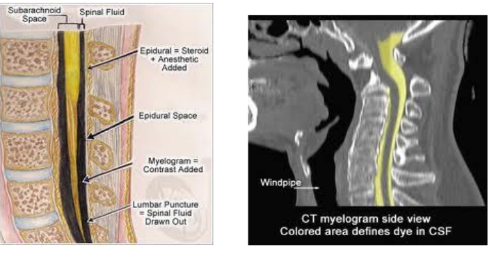 IR( interventional radiology)-9