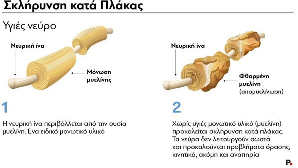 ΑΓΆΠΗ ΓΙΑ ΖΩH: ΣΚΛΗΡΥΝΣΗ ΚΑΤΑ ΠΛΑΚΑΣ ΚΑΙ ΥΓΕΙΑ