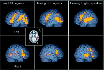 Sign Language Helps to Understand the Functioning of the Brain