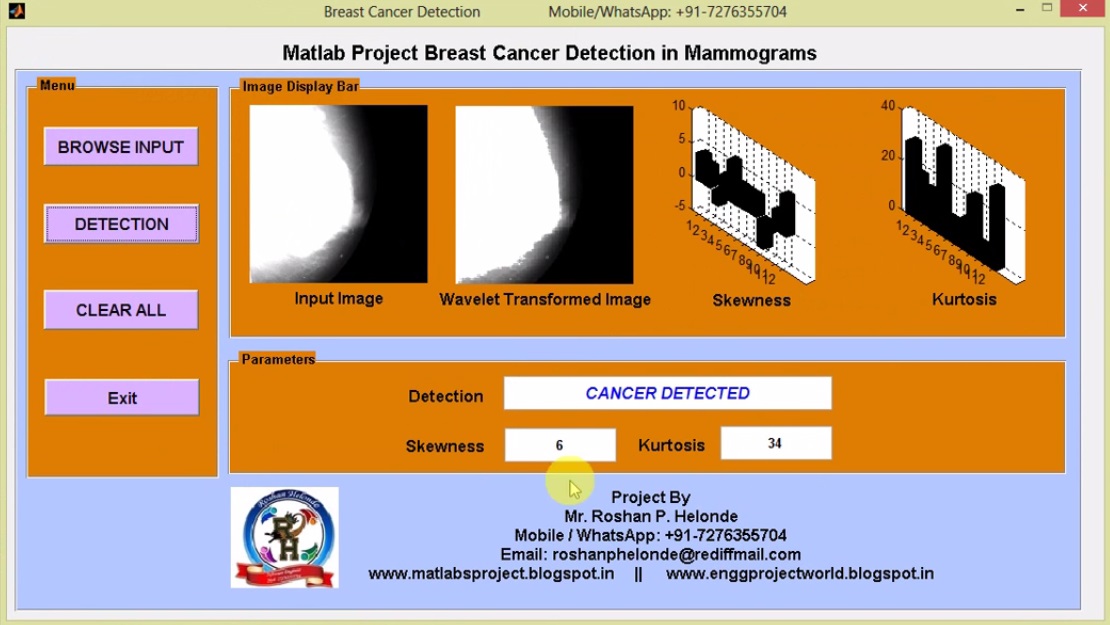Matlab Project Breast Cancer Detection In Mammograms Full Source Code