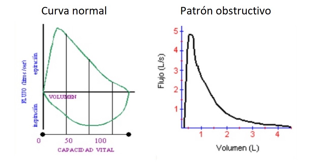 Técnicas y procedimientos de Enfermería: ESPIROMETRÍA