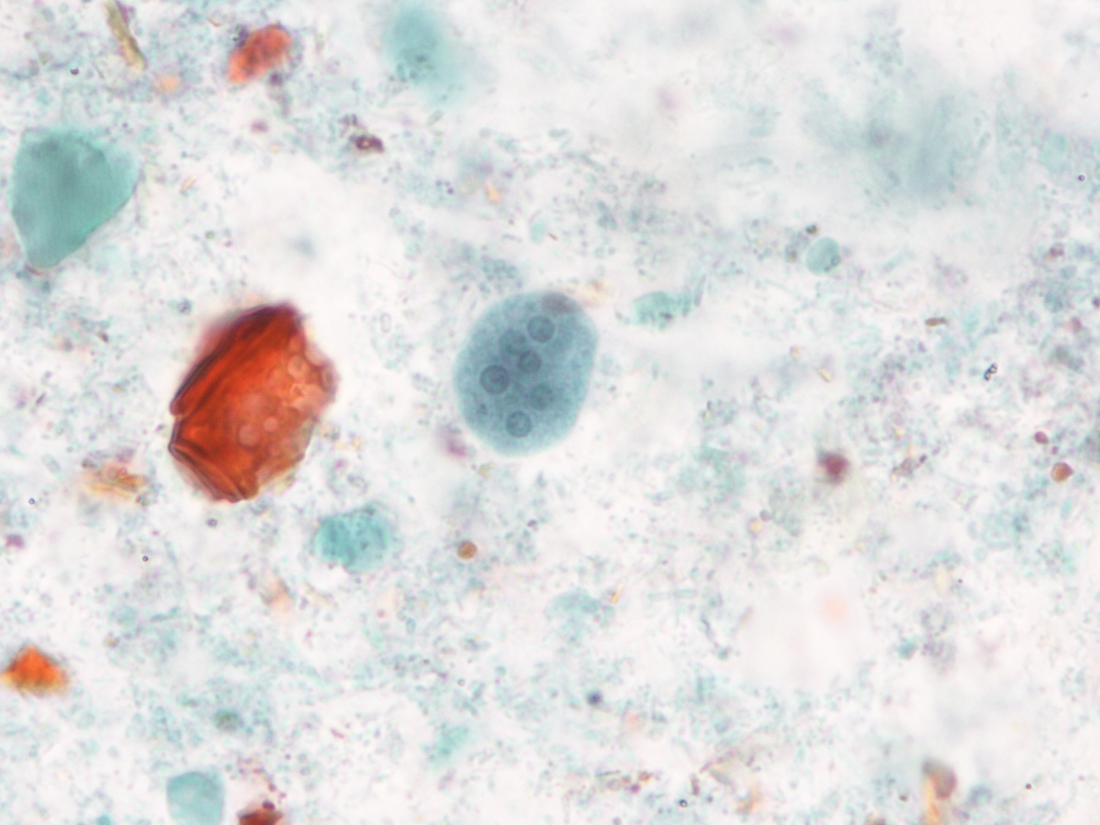 Creepy Dreadful Wonderful Parasites: Case of the Week 489