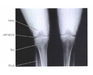 TEKNIK PEMERIKSAAN KNEE JOINT
