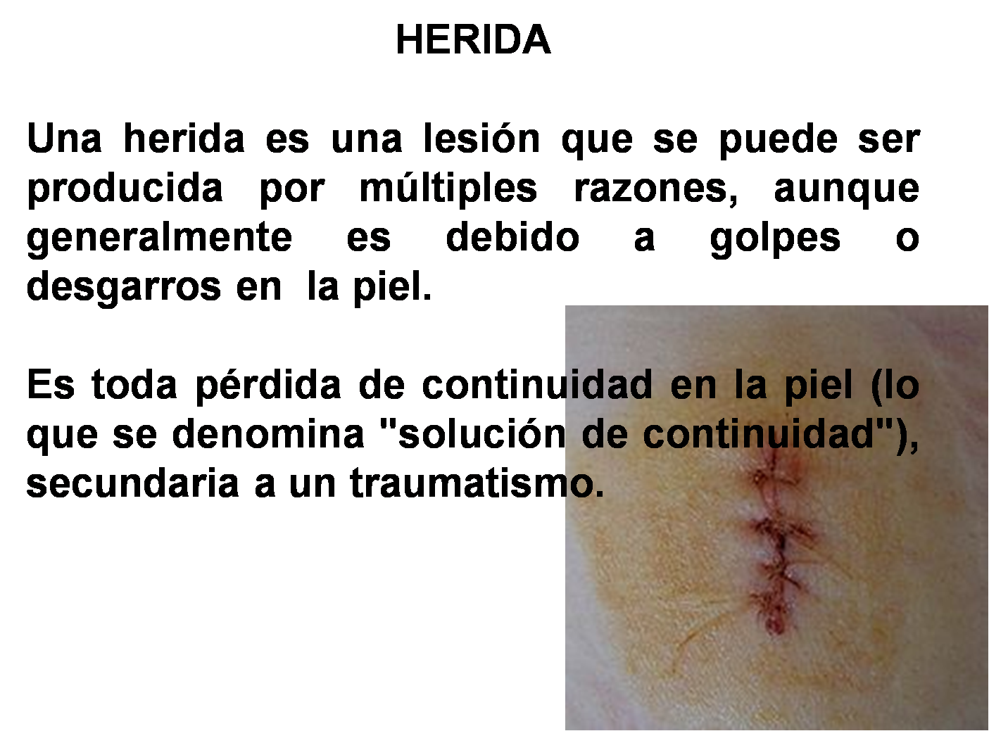 HERIDAS: HERIDAS Y CONTUSION