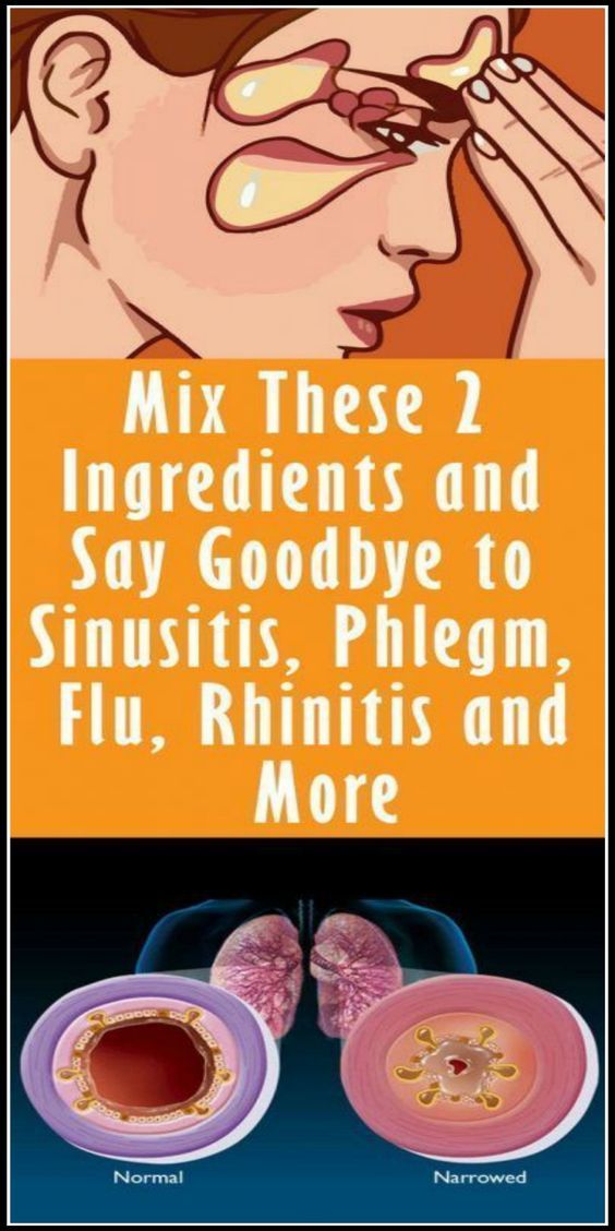 Mix These 2 Ingredients and Say Goodbye to Sinusitis, Phlegm, Flu ...