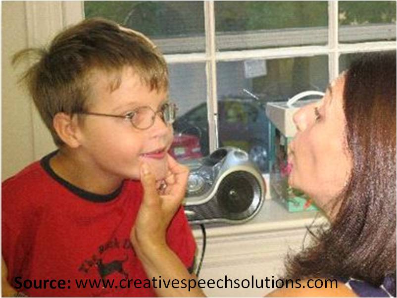 Dunia Palsi Serebrum: Terapi Pertuturan