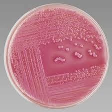 Mikrobiologi: MACAM MACAM MEDIA