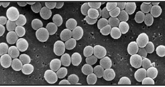 O que são as superbactérias e a resistência bacteriana? - Saber Atualizado