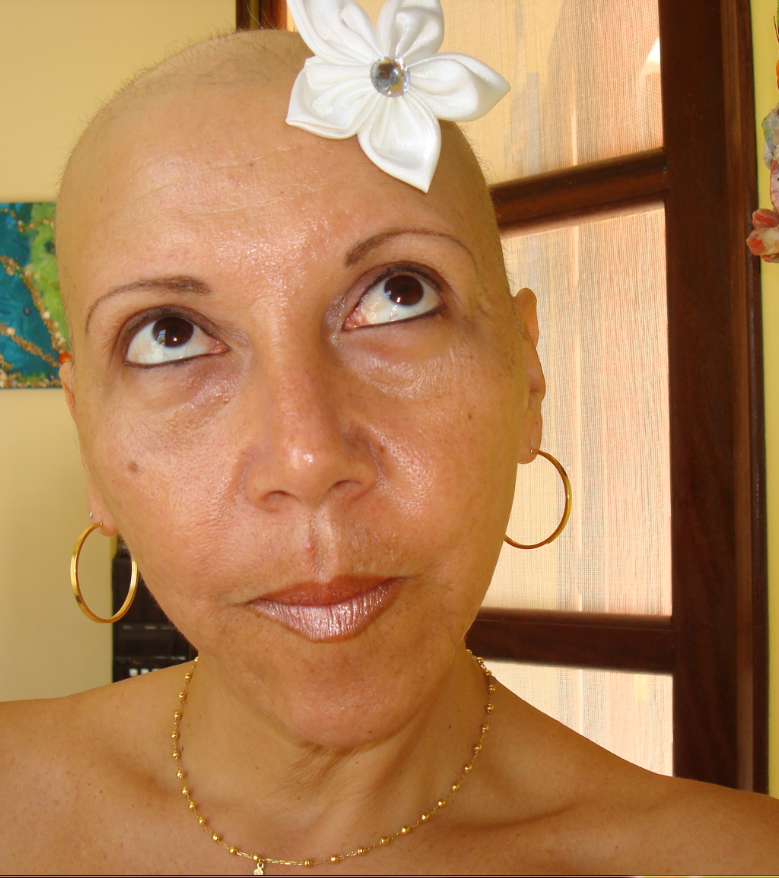 Denise David: Belas carecas!