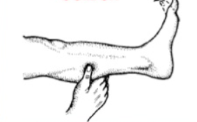 DIPLOMADO AEROMEDICINA : REFLEJOS PATOLOGICOS