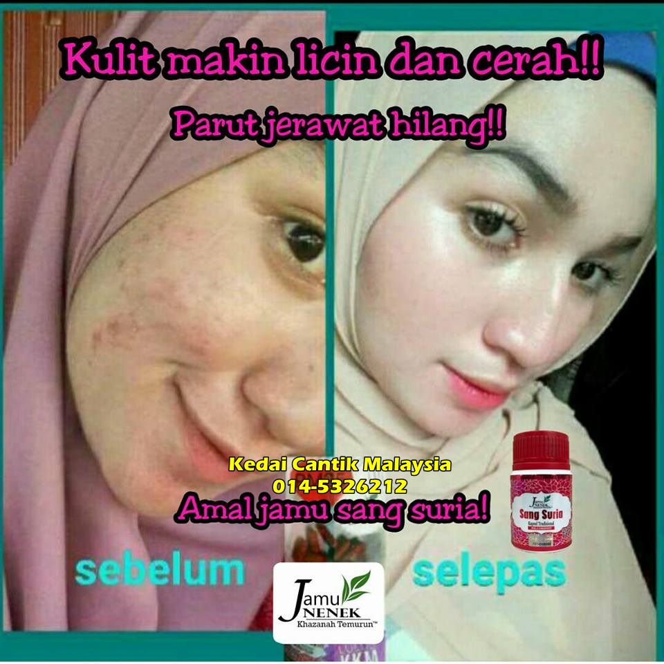 JAMU NENEK SANG Suria – Merawat Masalah KULIT & RESDUNG - KEDAI CANTIK ...