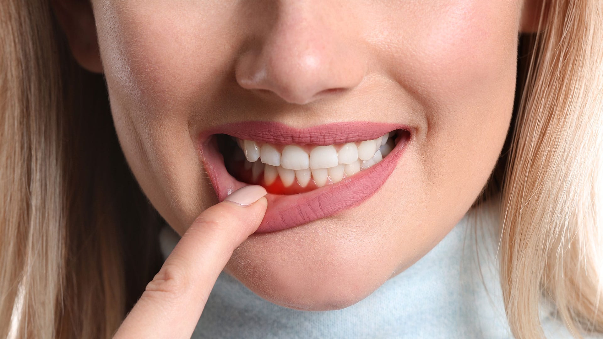 Causas y Consecuencias de la Periodontitis │Tratamiento Casero