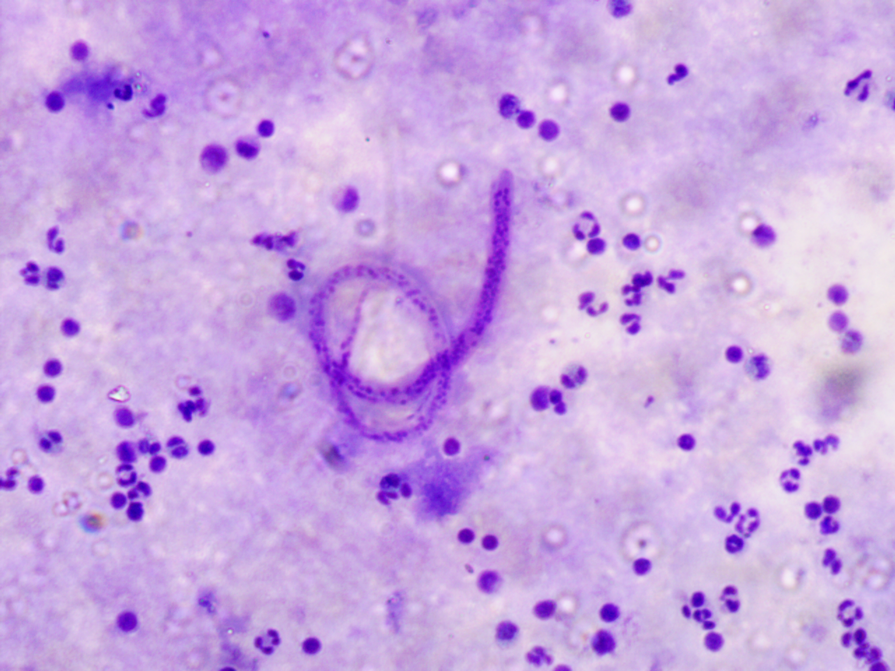 into the roots: Parasites