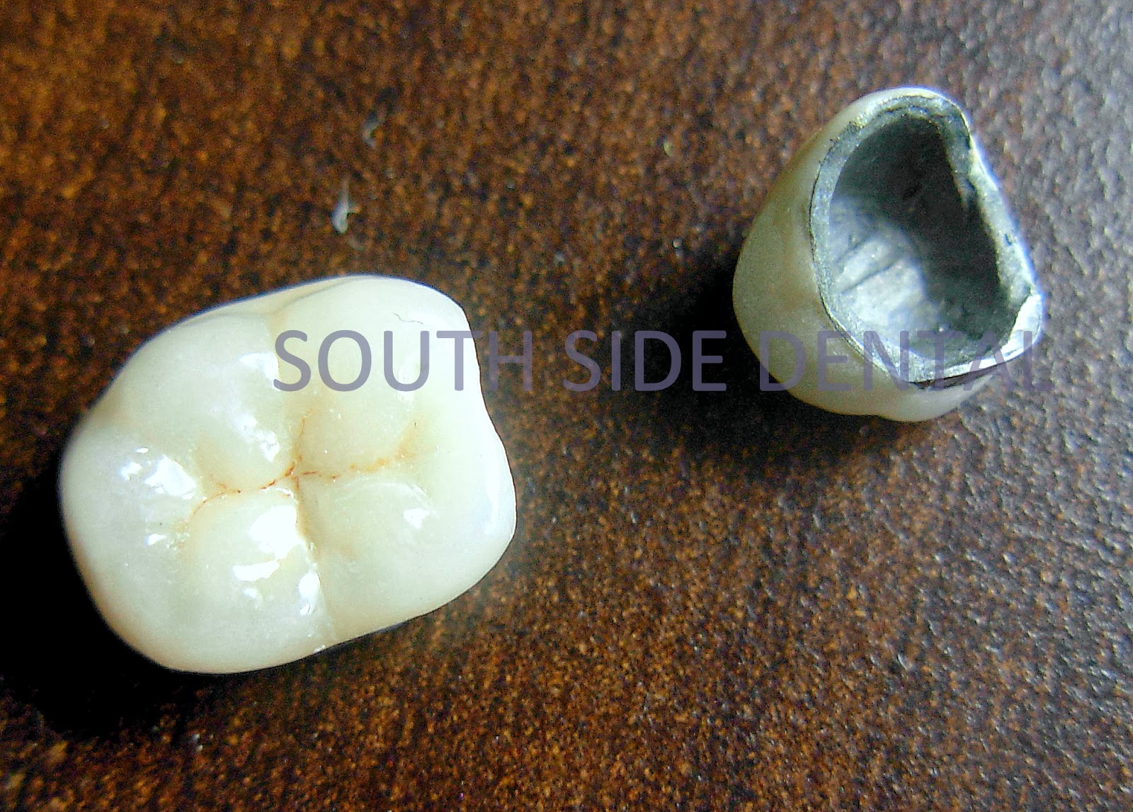 SOUTH SIDE DENTAL
