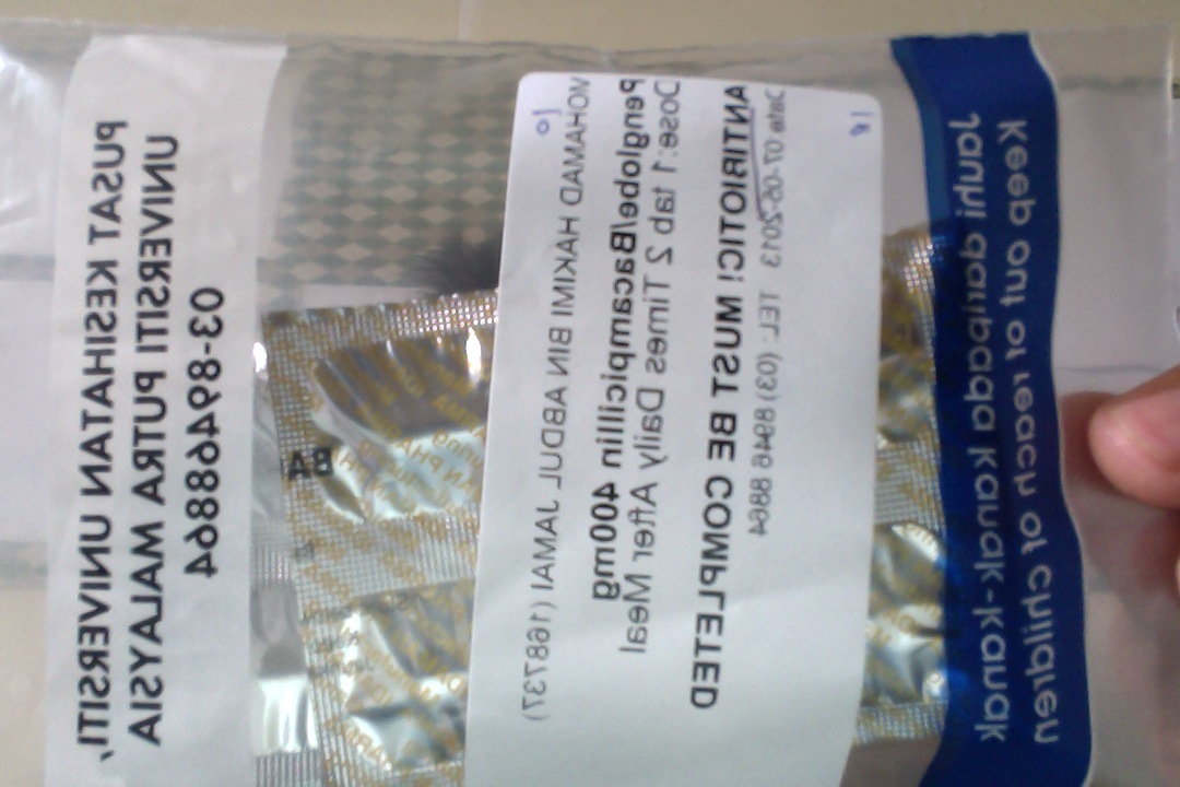 Pengalaman: Apa itu Gigi Graham Bongsu? - Blog Kimi Jamai