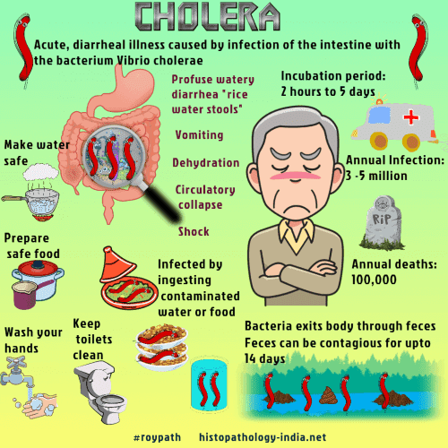 કોલેરા થી બચવાના ઉપાયો,cholera treatment,Best home remedies for cholera ...