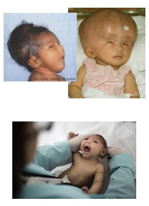 Nursing Care: PEMERIKSAAN FISIK NEONATUS (Unit 5)