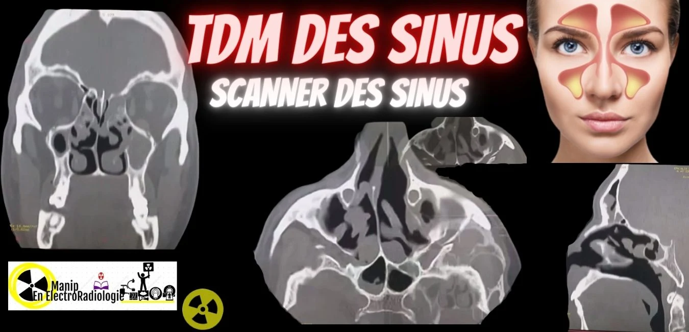 SCANNER DES SINUS