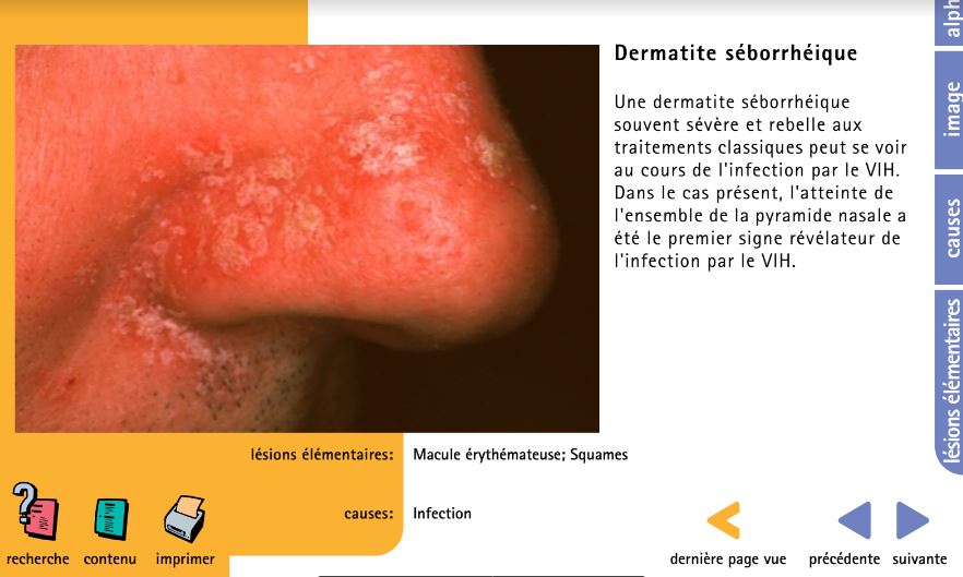 lesion elementaire en dermatologie pdf