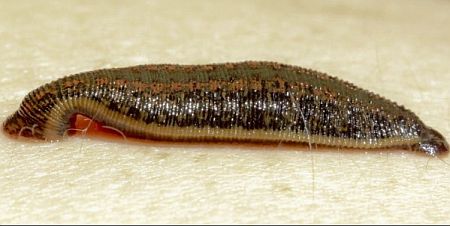 ڈاکٹروں نے شہری کی ناک سے جونک نکال لی | چکوال پوسٹ