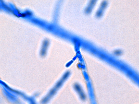 Fun With Microbiology (What's Buggin' You?): Arthrographis species