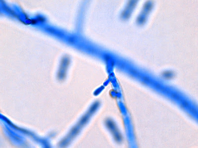 Fun With Microbiology (What's Buggin' You?): Arthrographis species