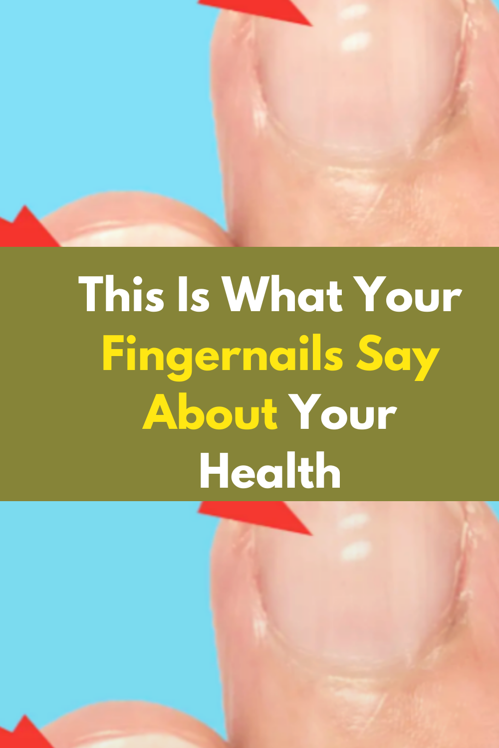 This Is What Your Fingernails Say About Your Health