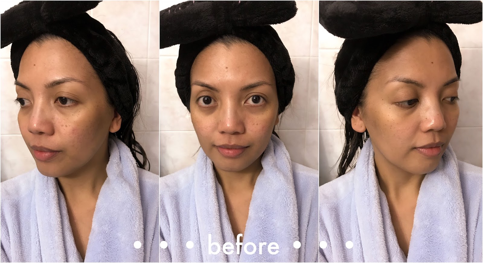 fivetwo beauty: Slowly but surely getting results with PMD Beauty