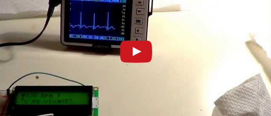 Electrocardiograph and Heart Rate Monitor Using an Arduino ...