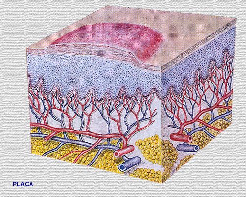 Aprendiendo estética: La piel y sus patologías.