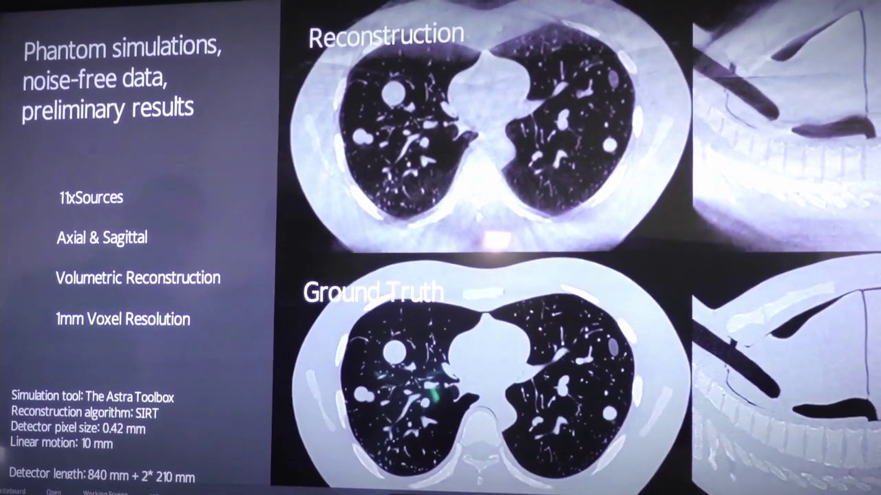 NaNOx Chronicles: CT vs Tomo vs Fluoro