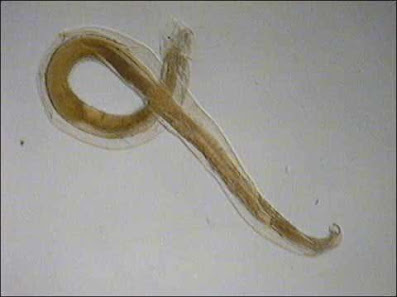 Blog de Biologia CMPA 201 2020: Material sobre nematelmintos