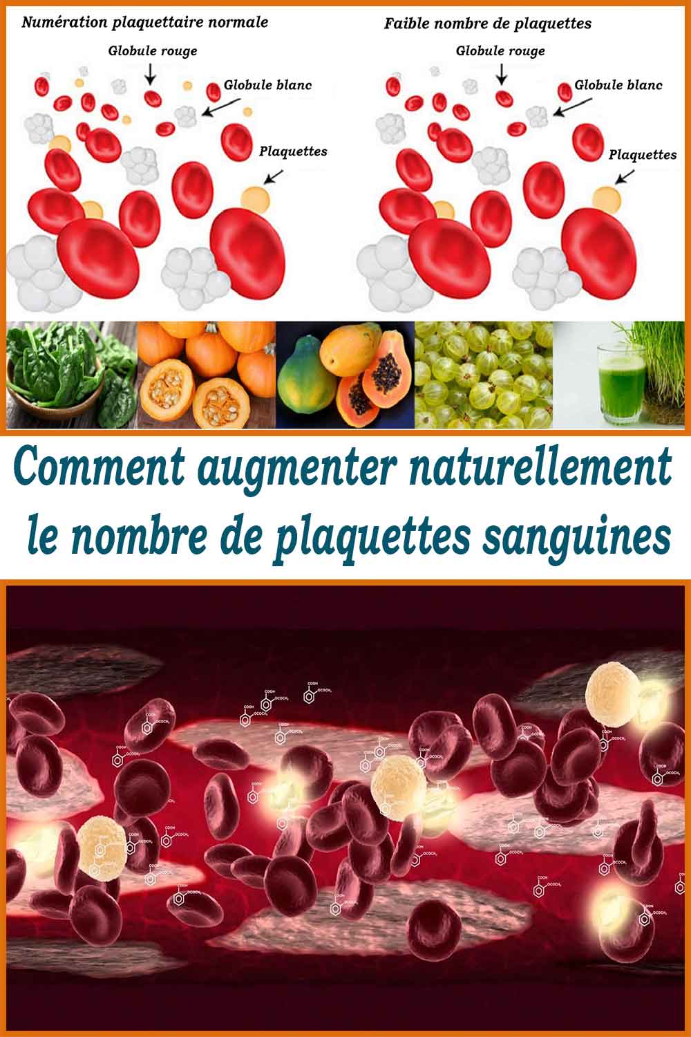 Comment augmenter naturellement le nombre de plaquettes sanguines ...