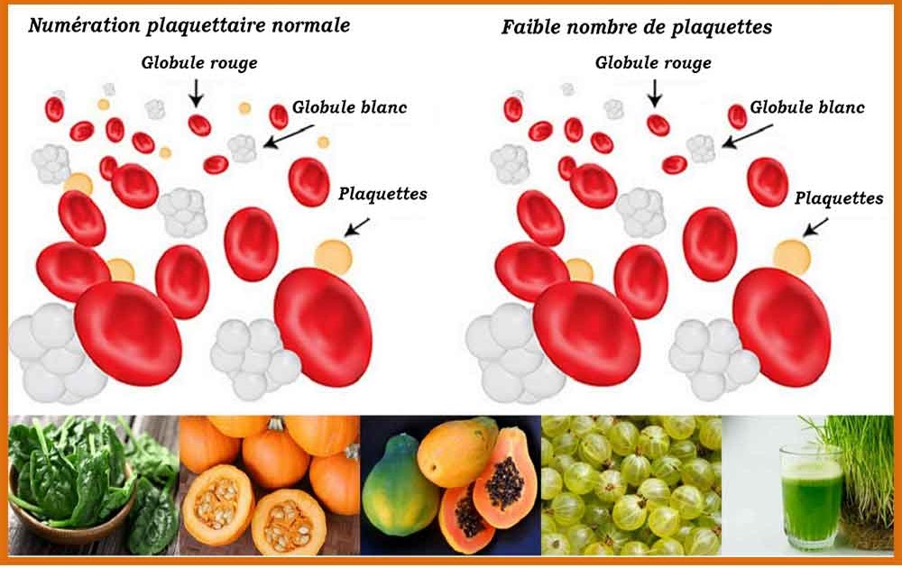 Comment augmenter naturellement le nombre de plaquettes sanguines ...
