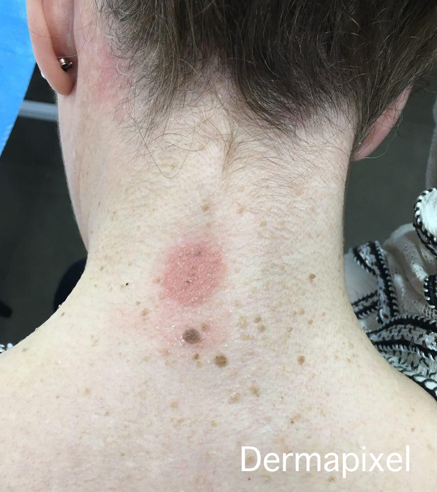 Dermapixel: mayo 2021